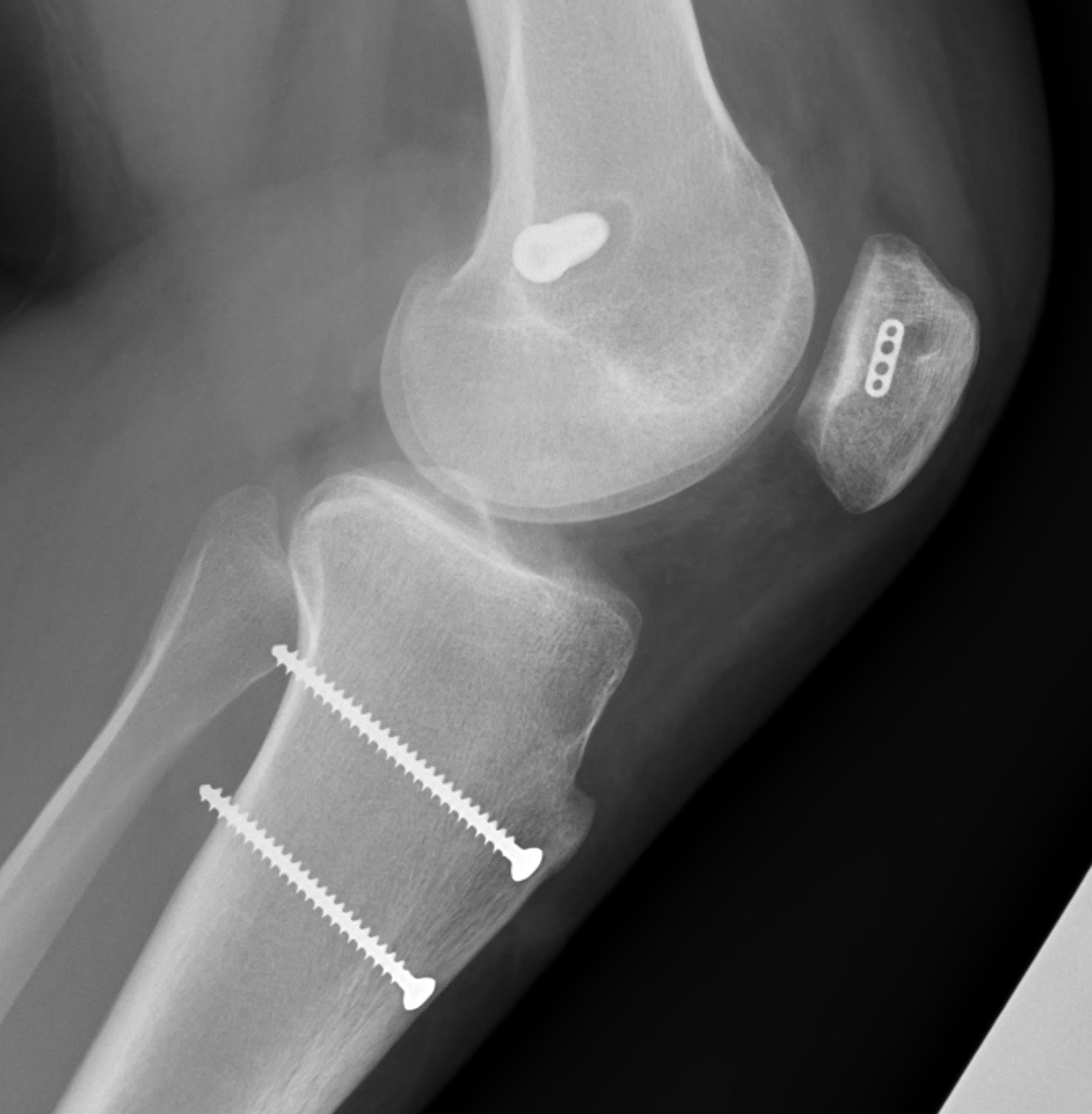 Kneecap Problems | Dr Simon Smith